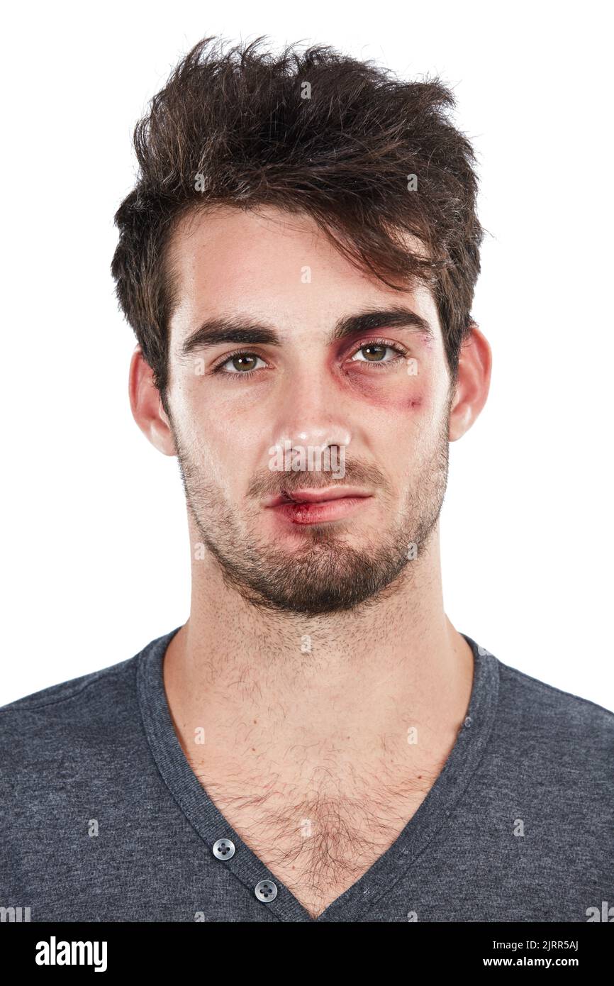 He got more than just his ego bruised. Studio portrait of a young man ... He got more than just his ego bruised. Studio portrait of a young man ...