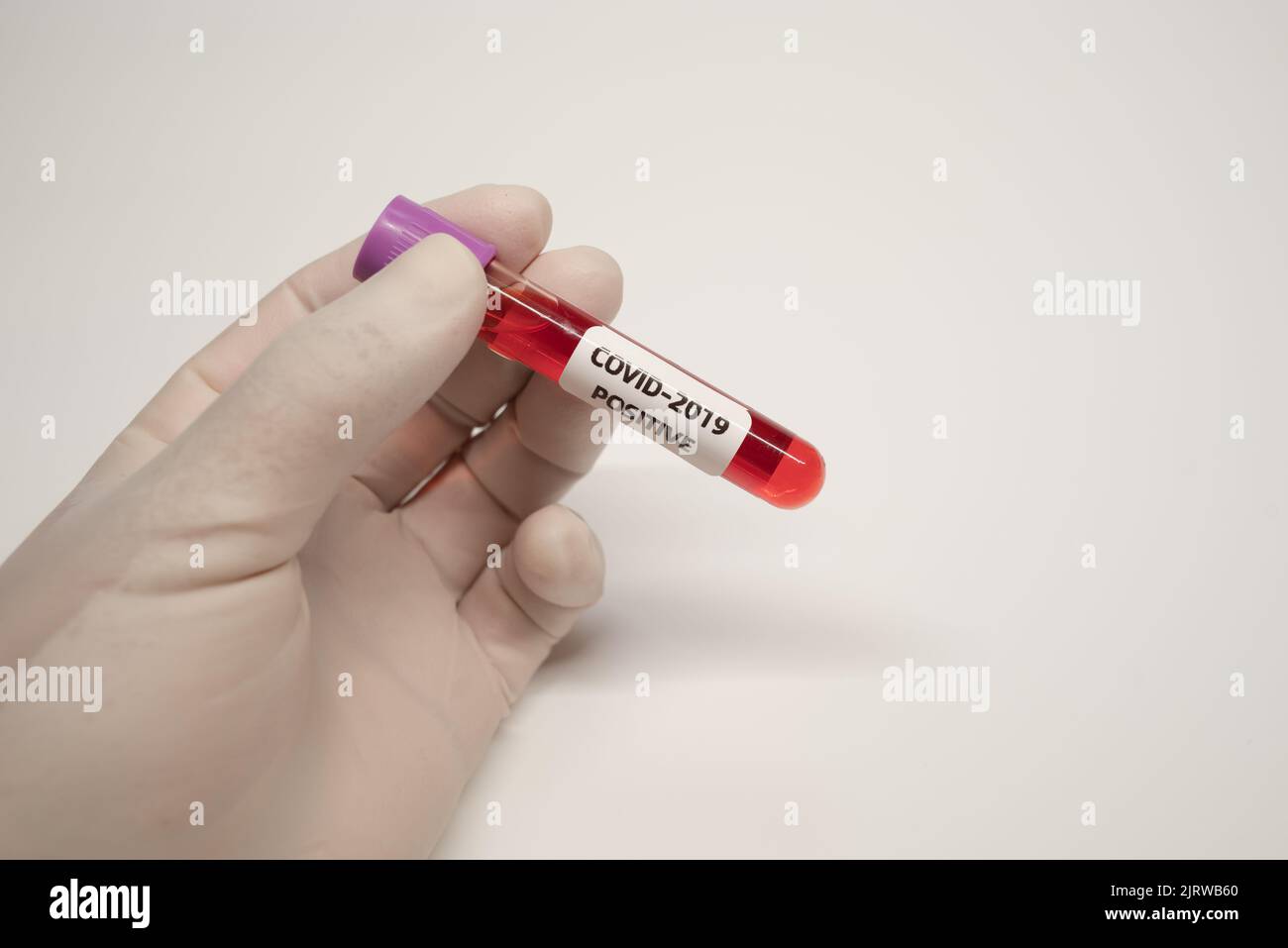 COVID-19 positive,Blood test Stock Photo - Alamy