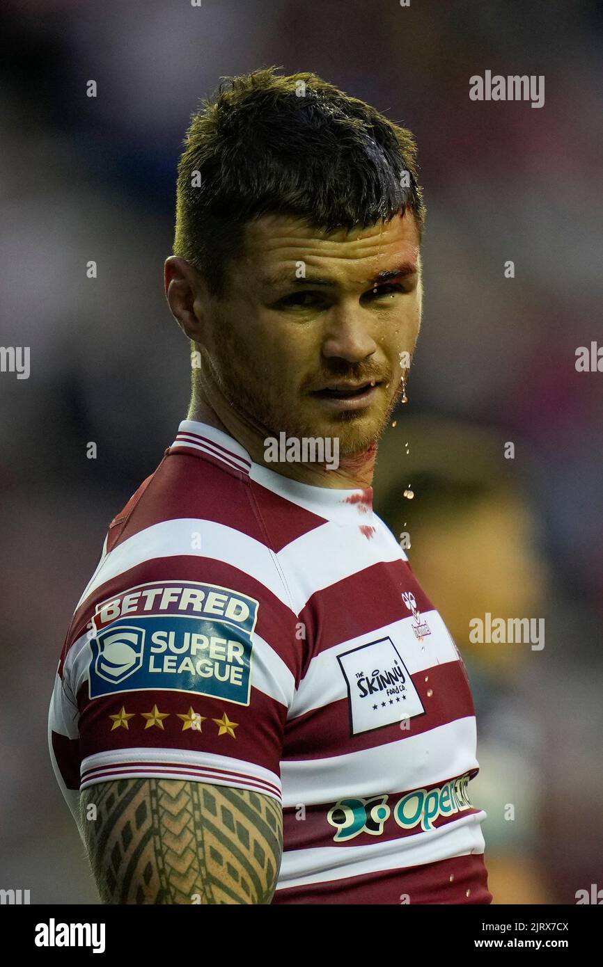 John Bateman #13 of Wigan Warriors gets treatment for a cut head Stock ...