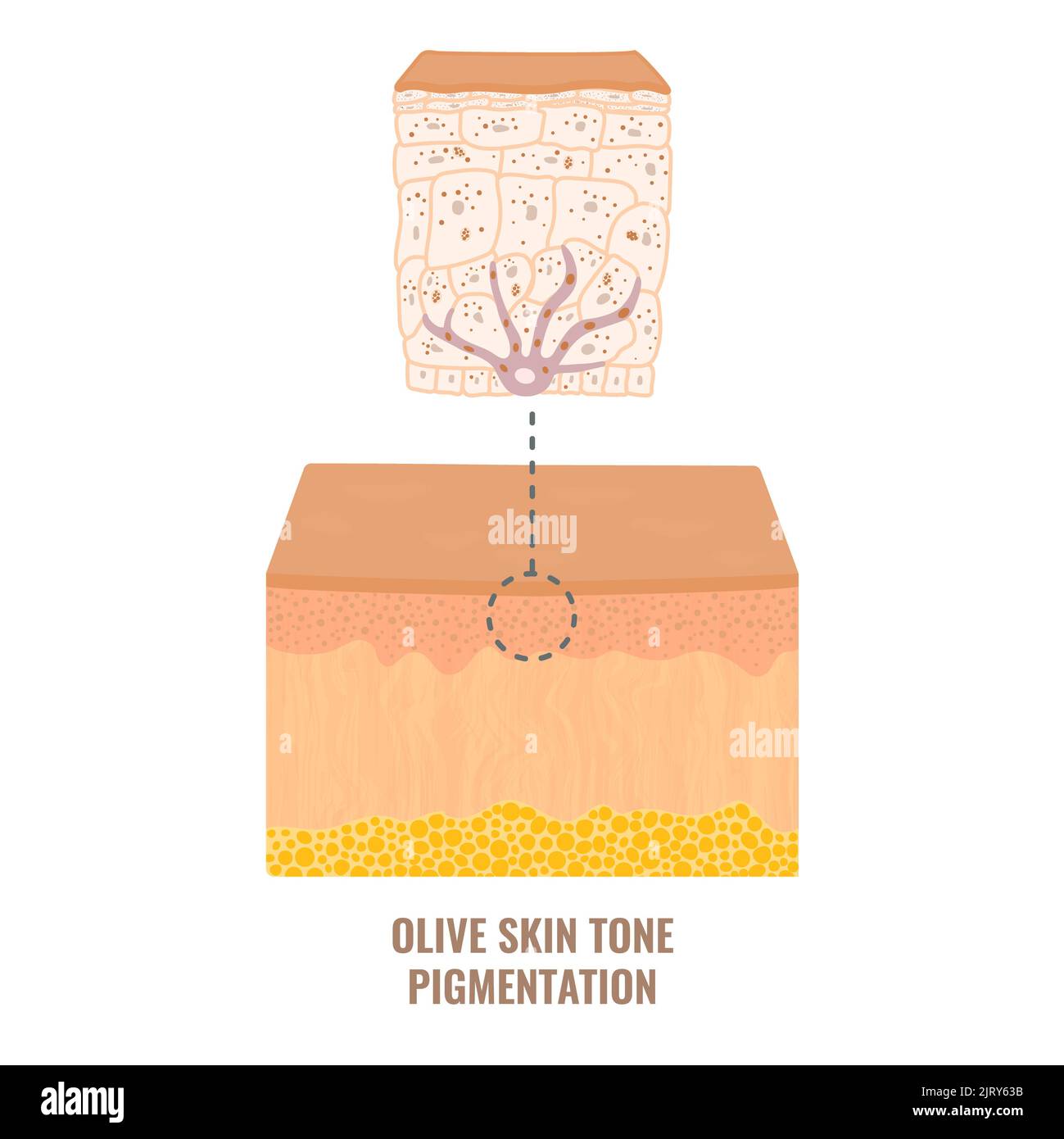 Skin pigmentation, illustration Stock Photo - Alamy