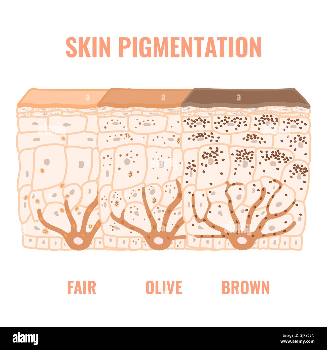 Skin pigmentation, illustration Stock Photo - Alamy