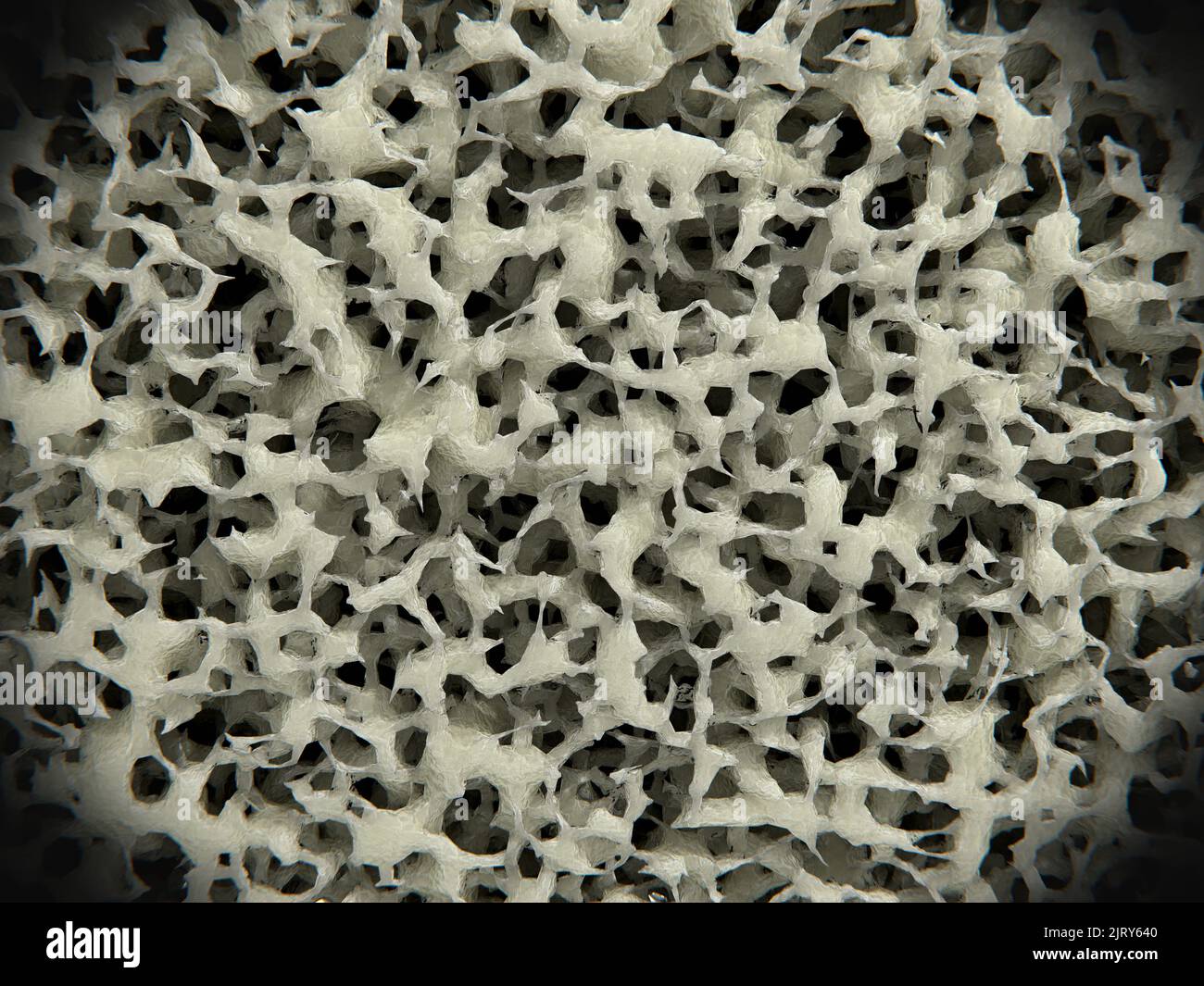 Bone loss hi-res stock photography and images - Alamy