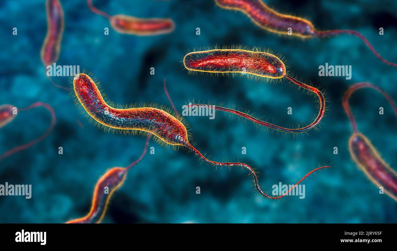 Cholera bacteria, illustration Stock Photo - Alamy