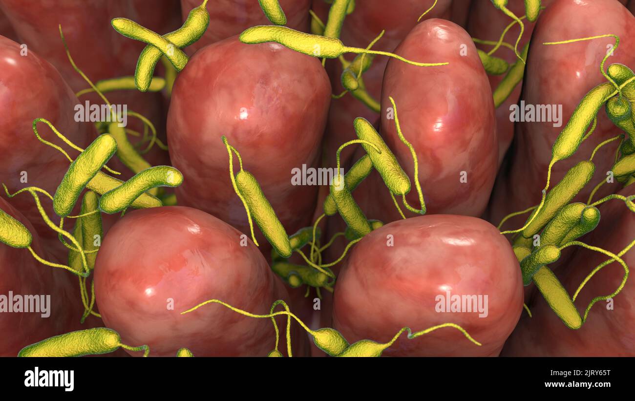 Cholera bacteria in human intestine, illustration Stock Photo - Alamy