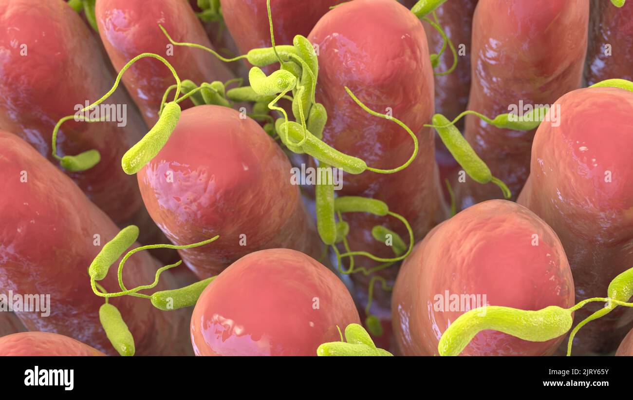 Cholera bacteria in human intestine, illustration Stock Photo - Alamy