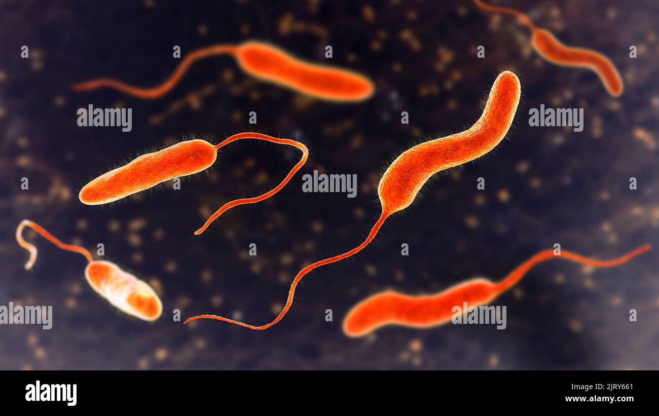 Cholera bacteria, illustration Stock Photo - Alamy