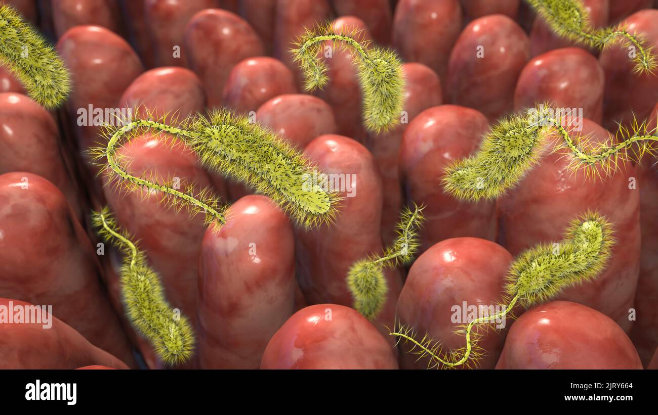 Cholera bacteria in human intestine, illustration Stock Photo - Alamy