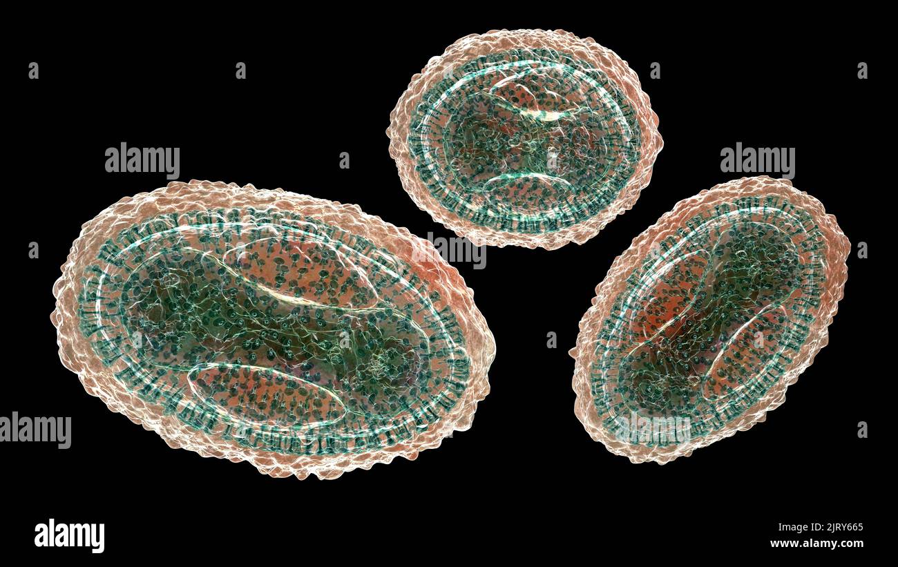 Smallpox virus, illustration Stock Photo - Alamy