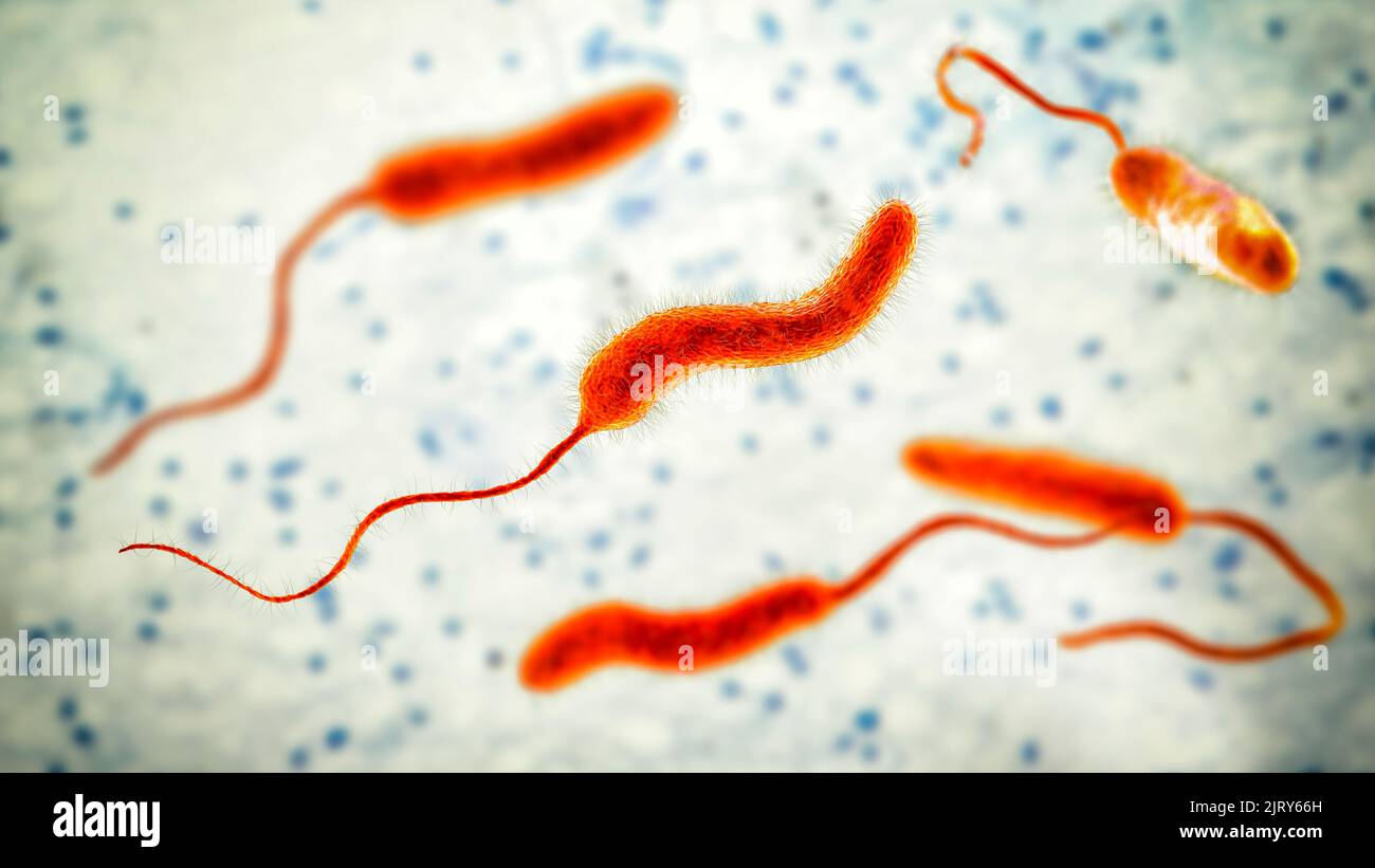 Cholera bacteria, illustration Stock Photo - Alamy