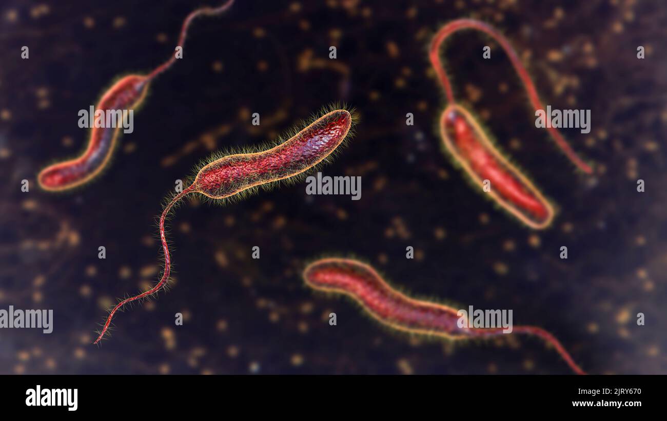 Cholera bacteria, illustration Stock Photo - Alamy