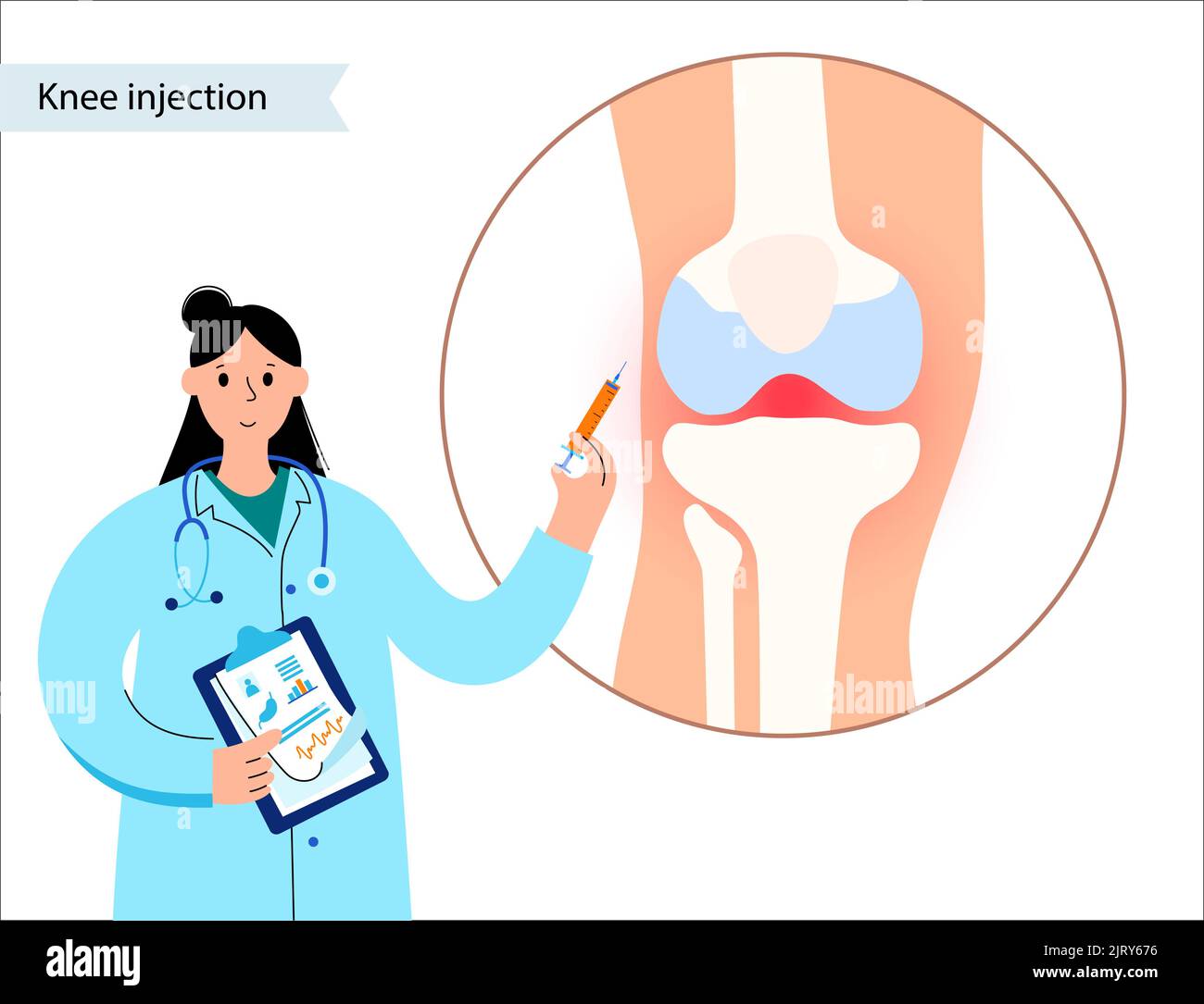 Corticosteroid injection hi-res stock photography and images - Alamy