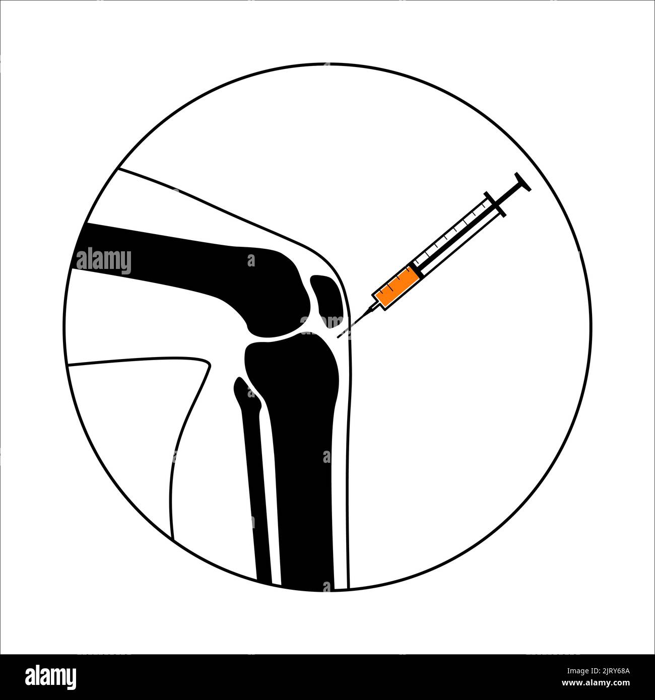 Knee injection, illustration Stock Photo - Alamy