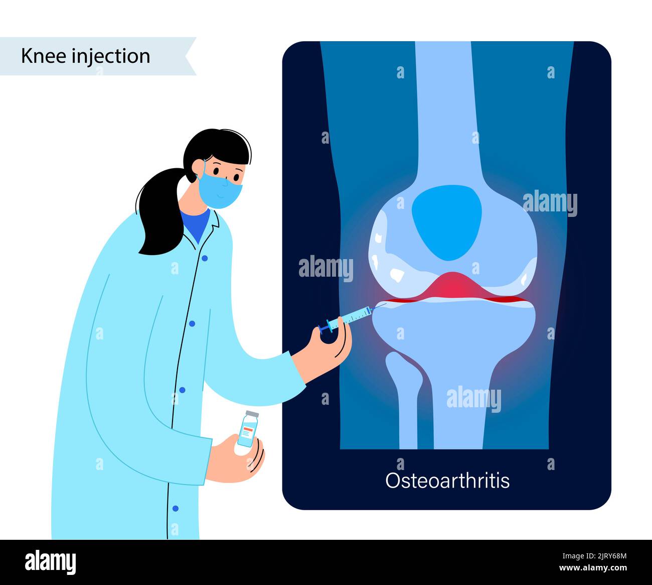 Knee injection, illustration Stock Photo - Alamy