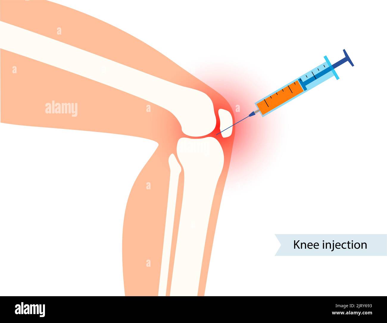 Hyaluronic acid knee hi-res stock photography and images - Alamy