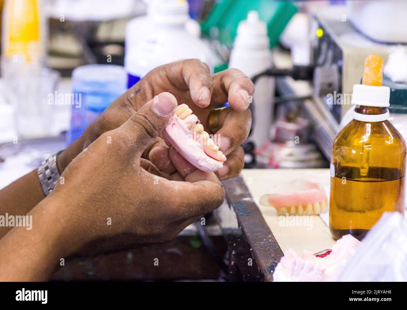 dental prosthesis mold in the hand of a prosthetic in rio de janeiro ...