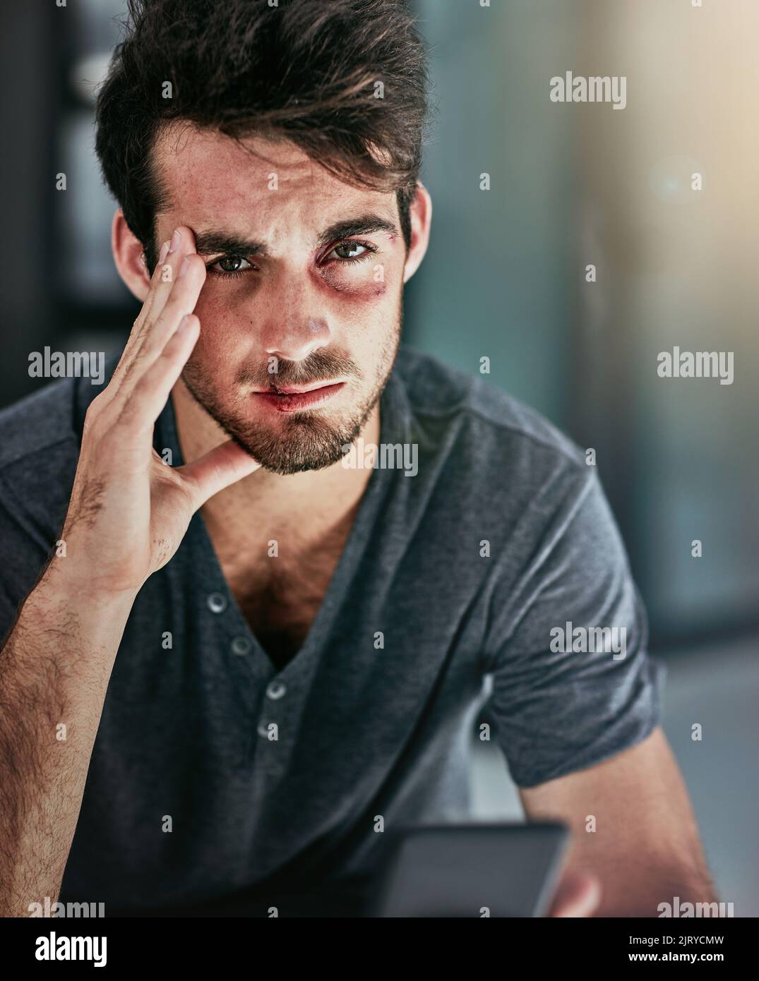 I got into another fight. Cropped portrait of a beaten and bruised ...