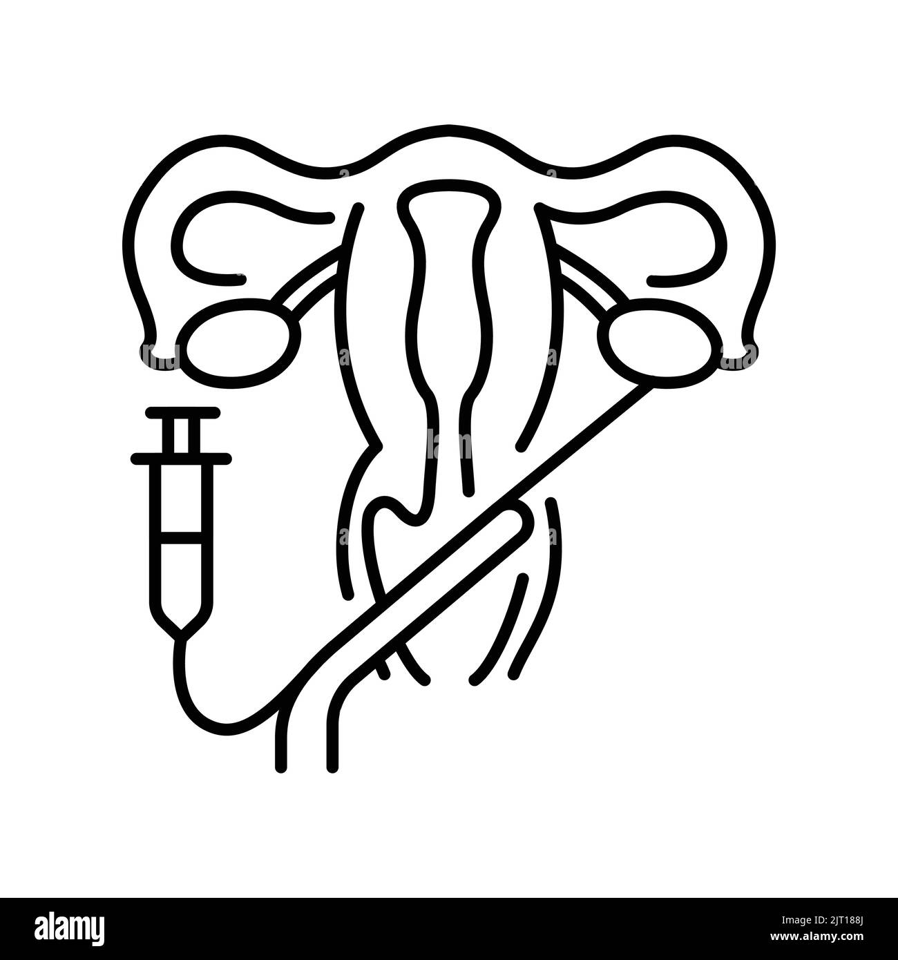 Transvaginal oocyte retrieval olor line icon. Pregnancy. Pictogram for ...