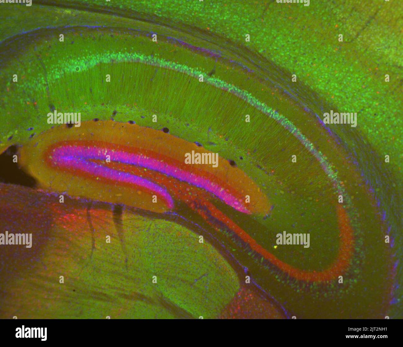 Transgenic mouse hippocamus Stock Photo - Alamy