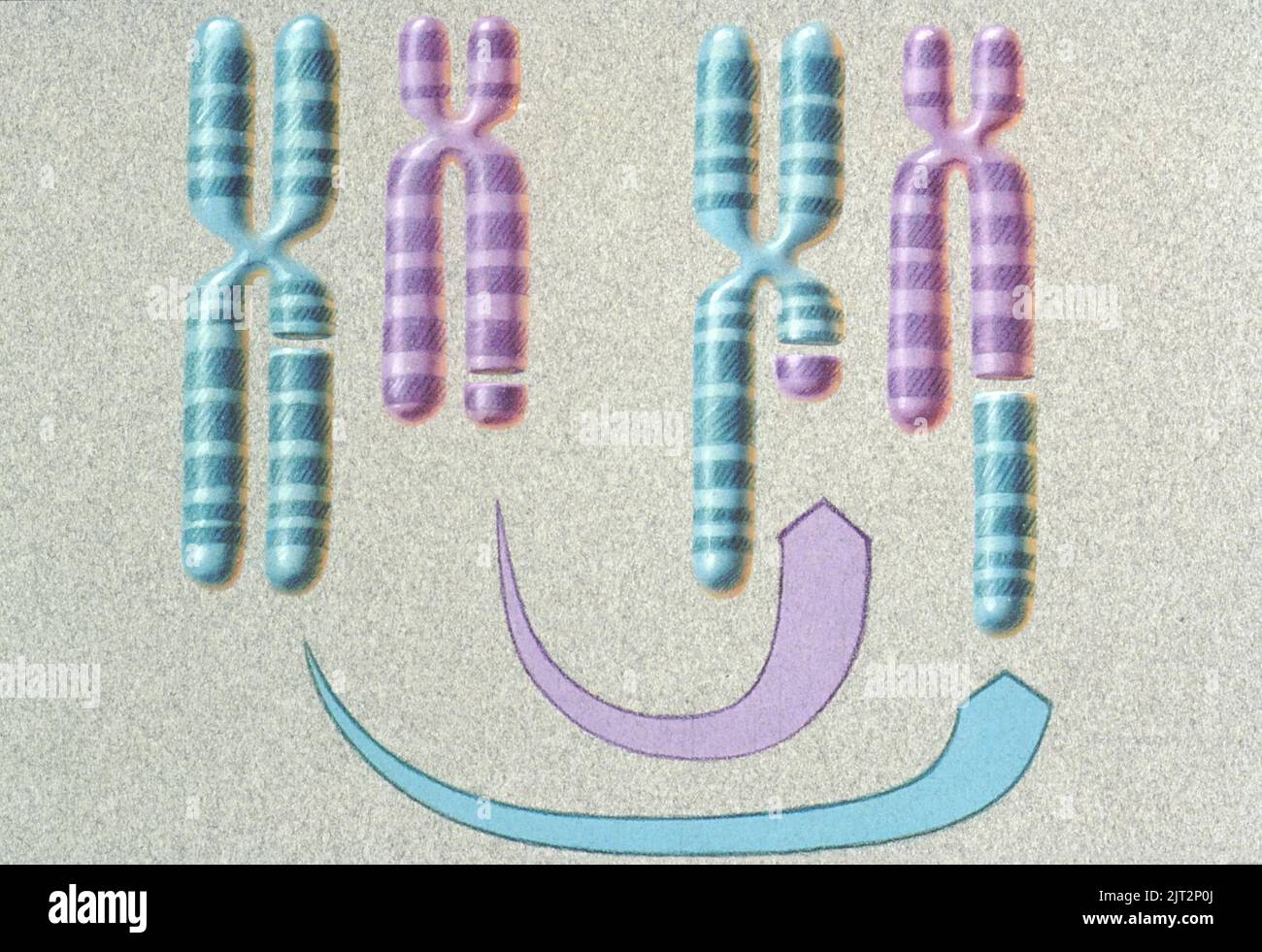 Translocation of chromosomes hi-res stock photography and images - Alamy