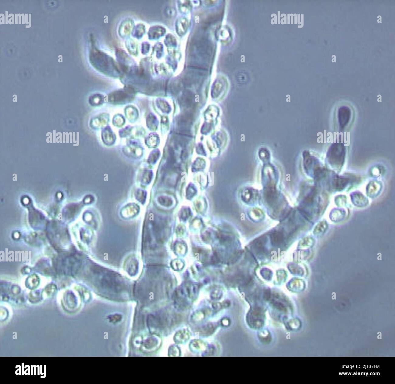 Trichoderma hi-res stock photography and images - Alamy