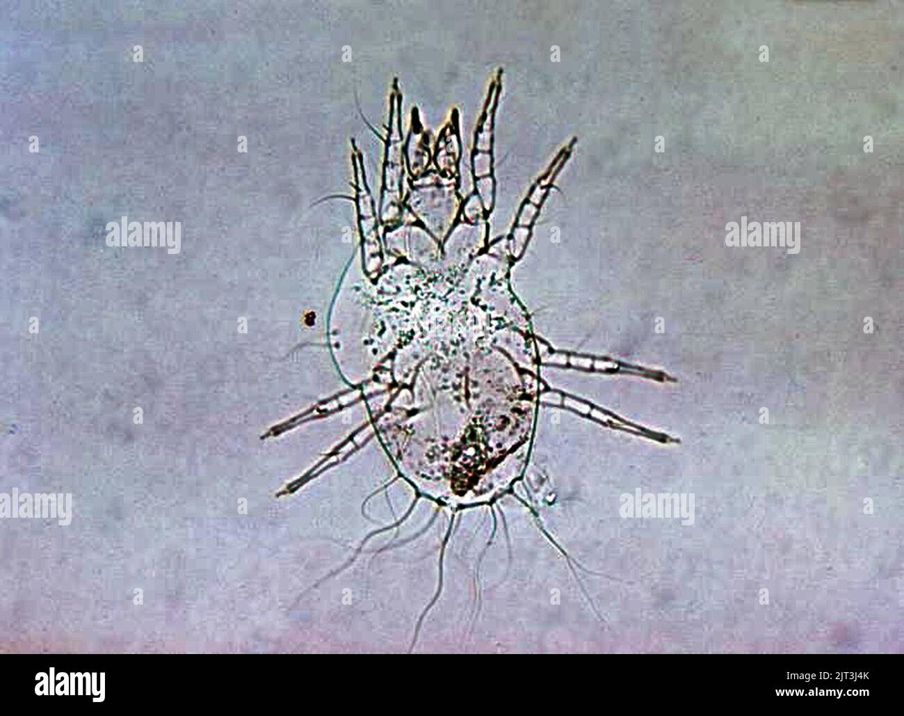 Trombicula hi-res stock photography and images - Alamy