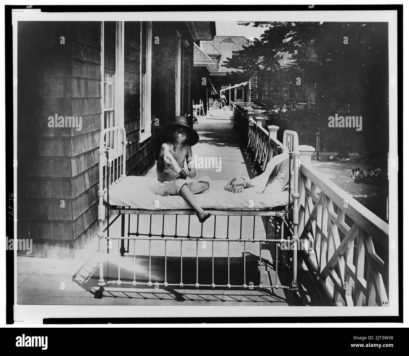 Tubercular child seated on bed, outdoors, at Sea Breeze Hospital, Coney ...