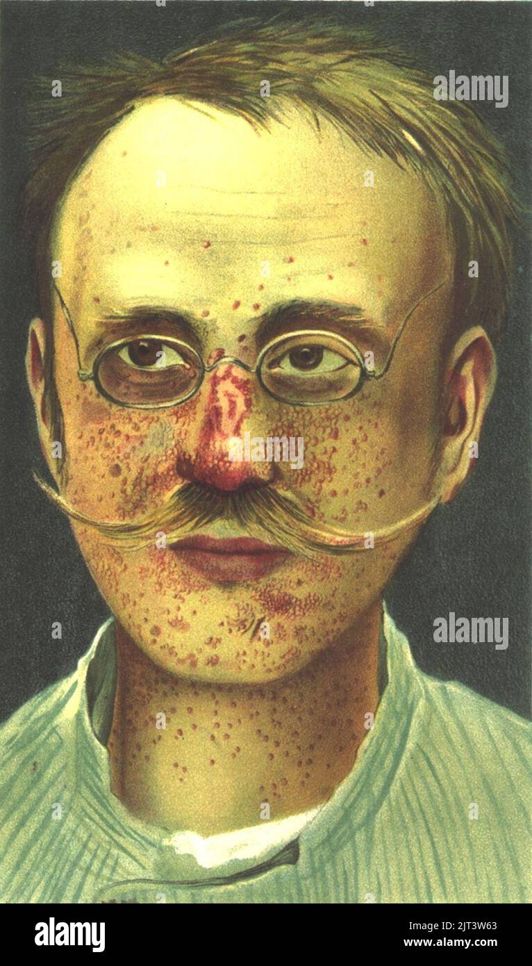 Kothe hi-res stock photography and images - Alamy