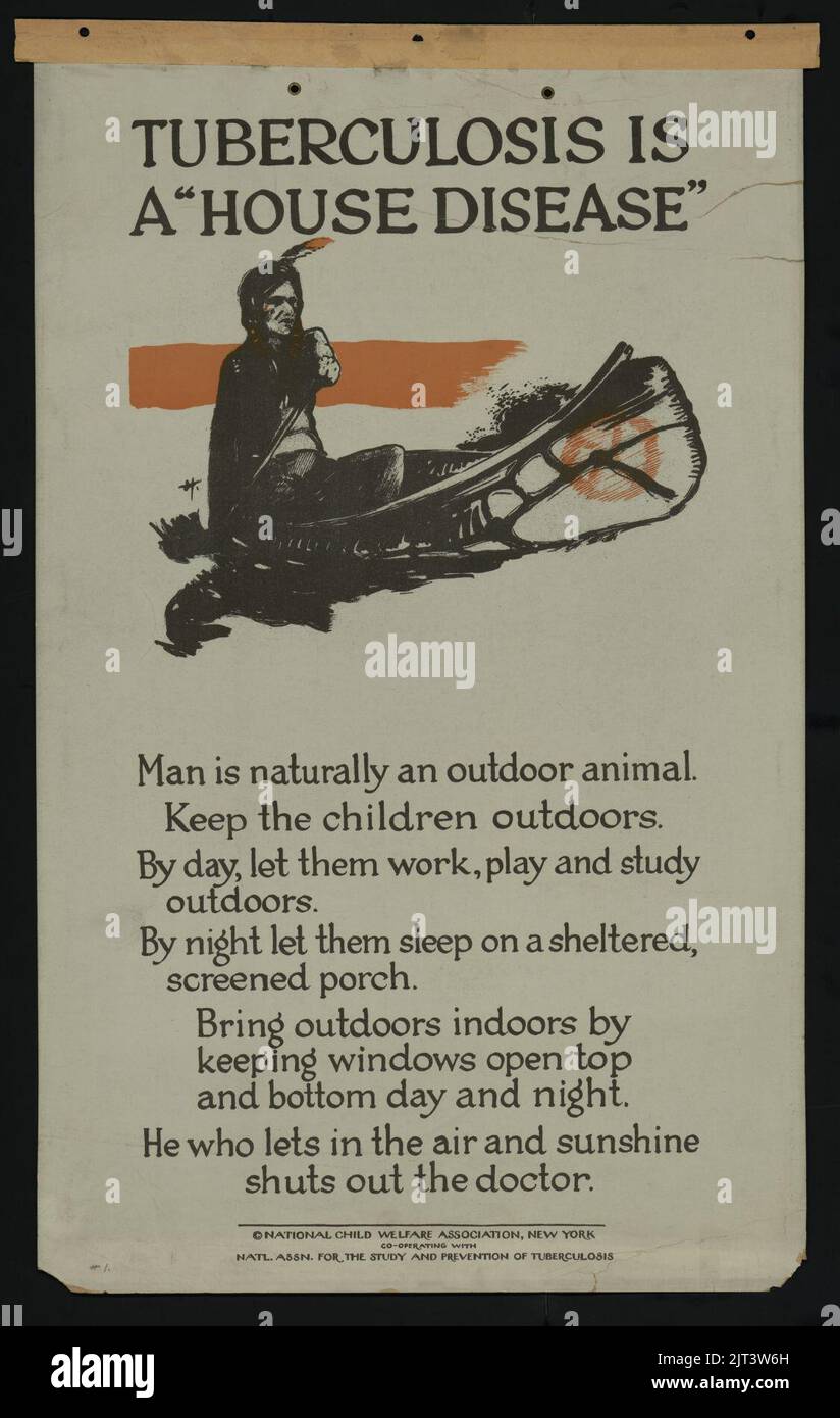 Tuberculosis is a ''house disease'' Stock Photo - Alamy