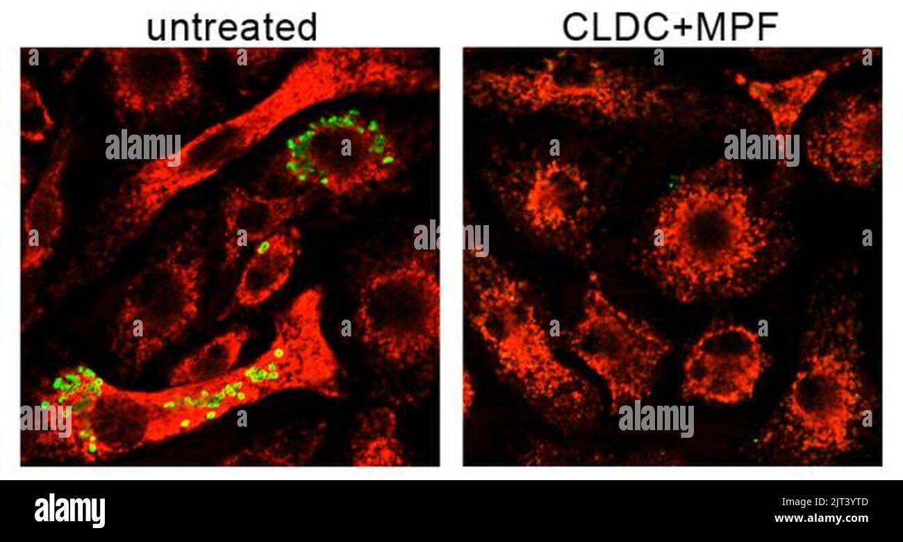 Tularemia Bacteria and Mouse Macrophages Stock Photo - Alamy