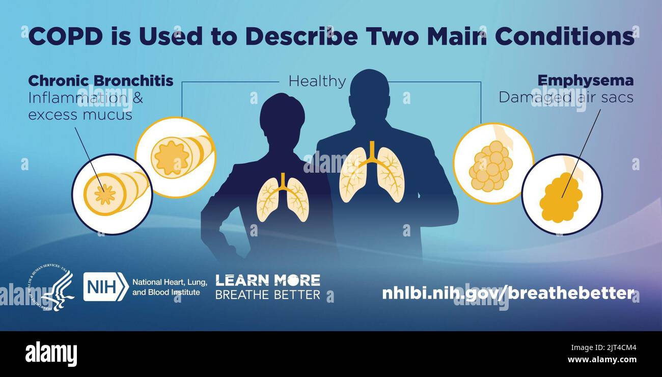 Two Conditions of COPD (49086386172 Stock Photo - Alamy