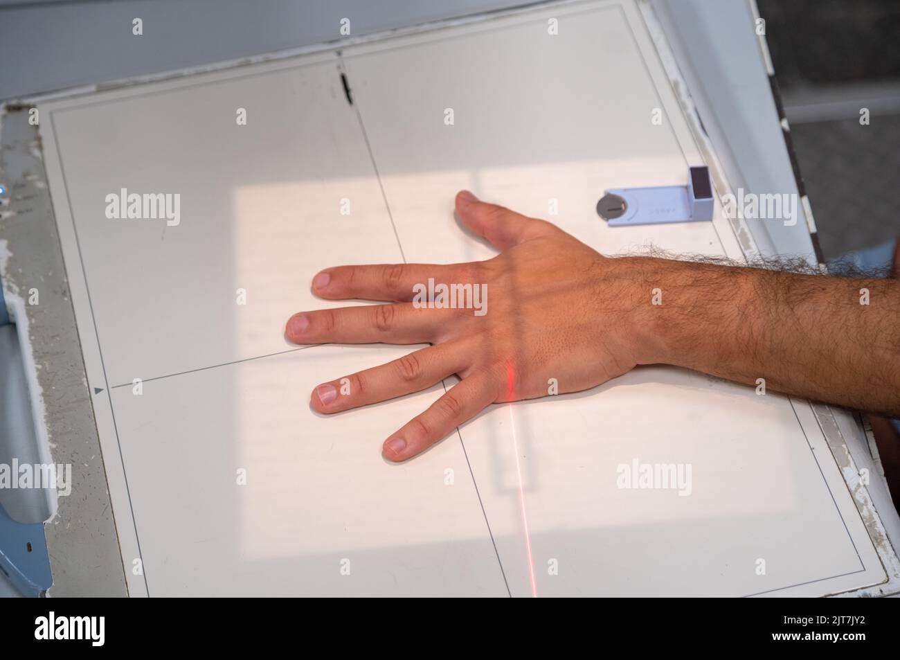 A hand x ray session ongloing in a radiology session Stock Photo - Alamy