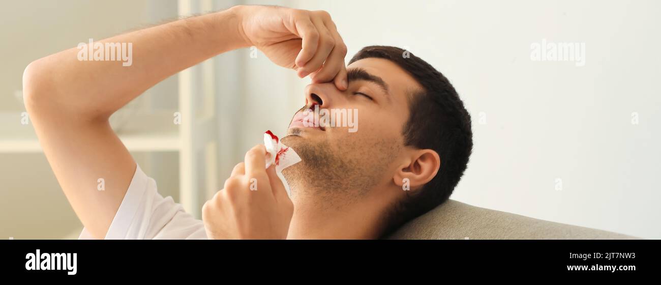 Young man nosebleed tissue hi-res stock photography and images - Alamy