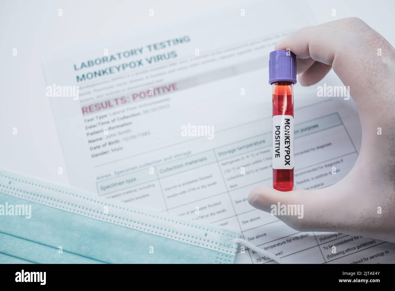 Blood Collection Tubes Test at Isabella Jolly blog
