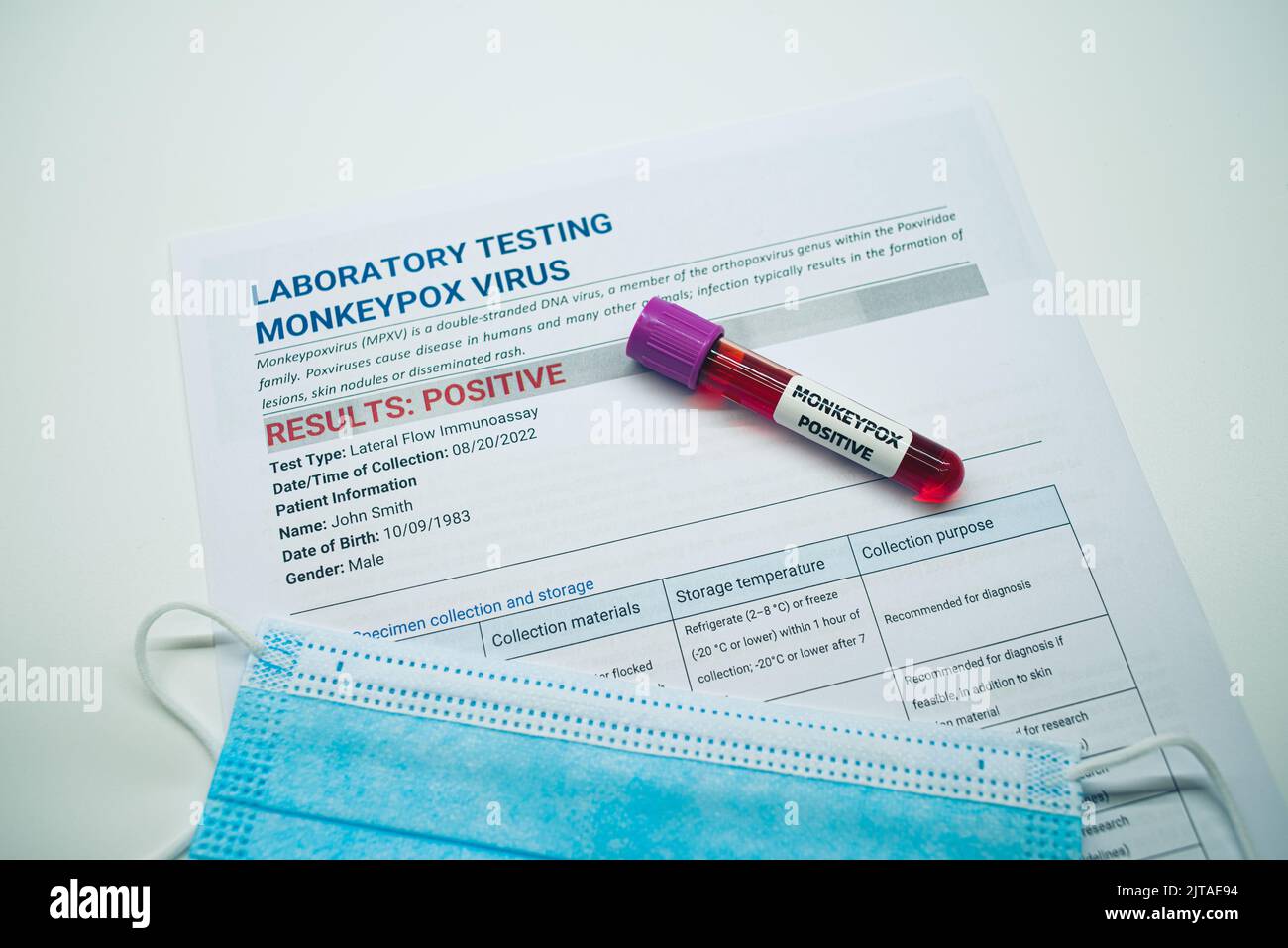 Blood collection tubes monkeypox test positive results Stock Photo - Alamy