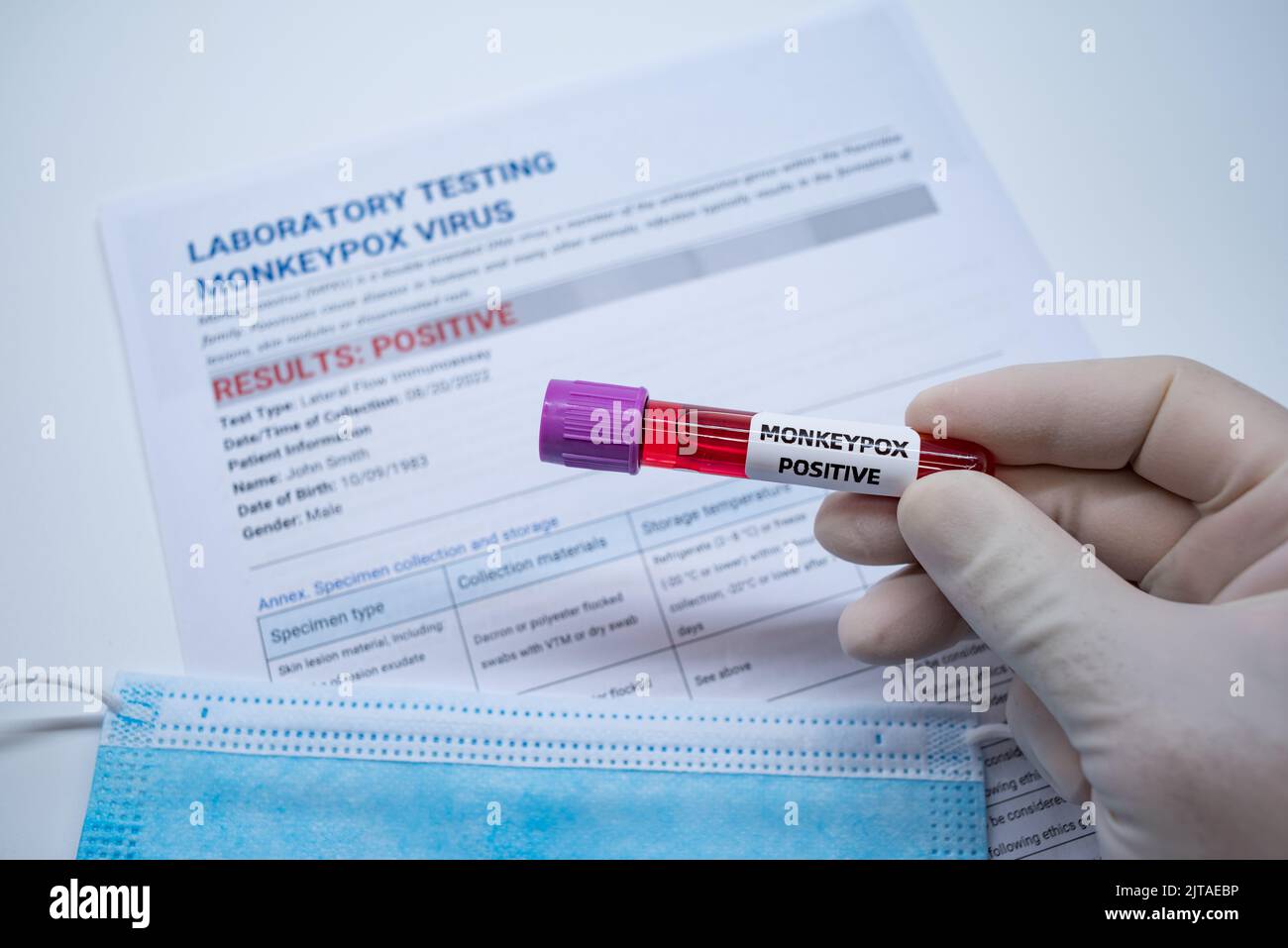 Blood collection tubes monkeypox test positive results Stock Photo - Alamy