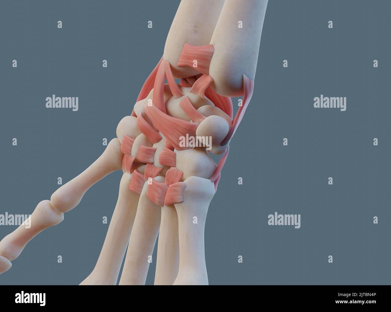Wrist Condylar Joint