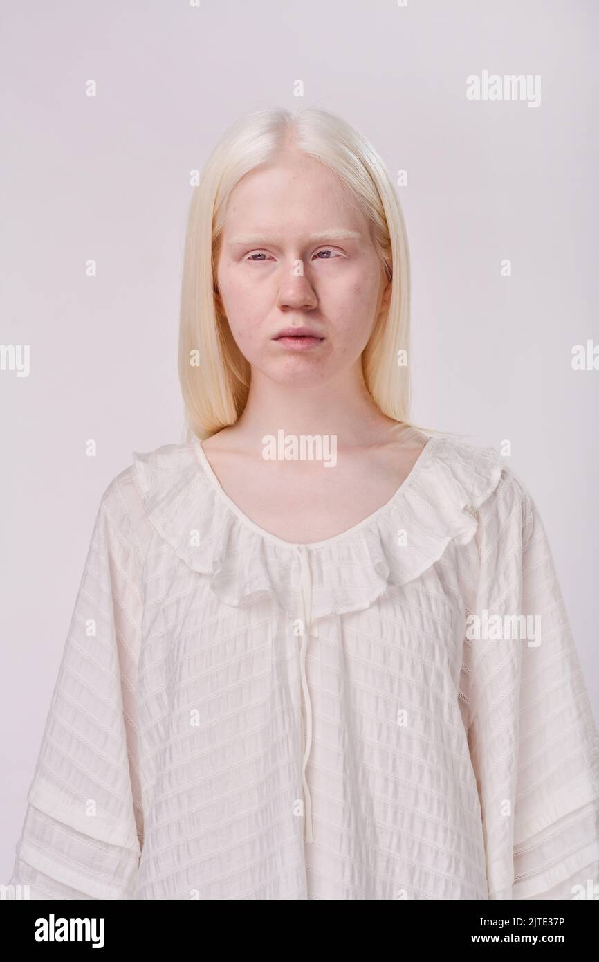 Portrait of young albino girl with white hair standing against white ...