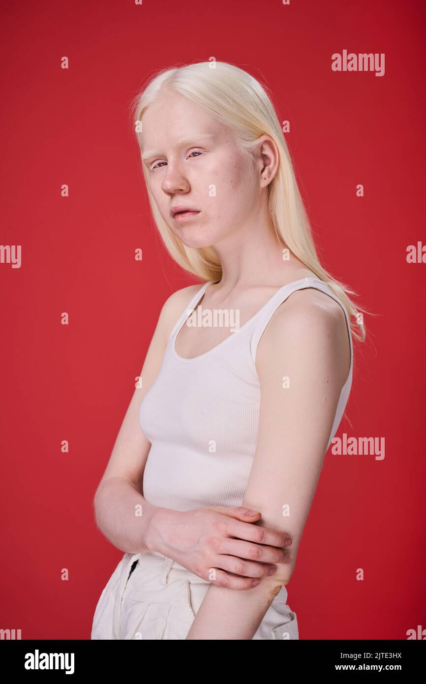 Portrait of albino girl with unusual appearance posing against red ...