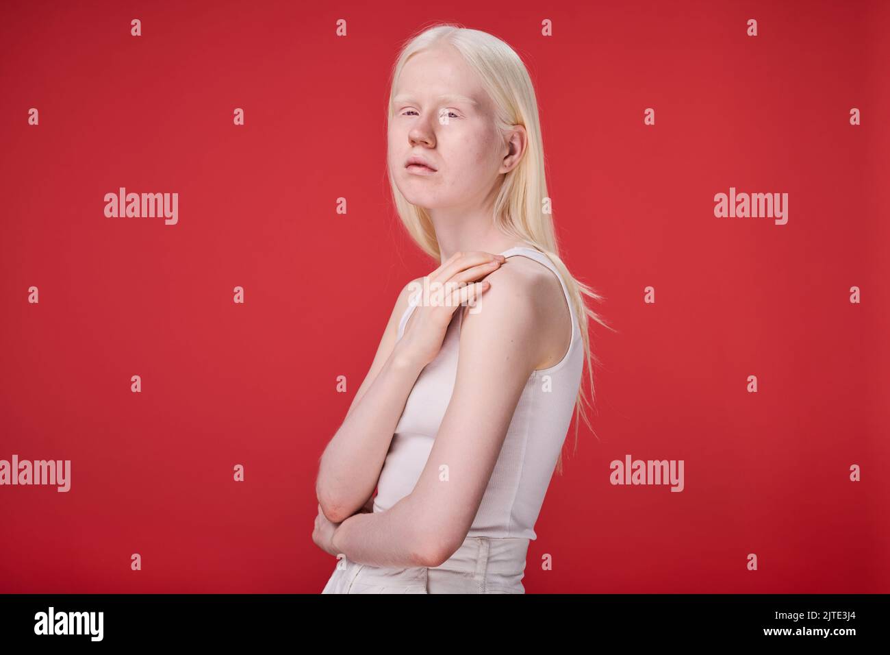 Portrait of albino girl with unusual appearance and natural beauty ...