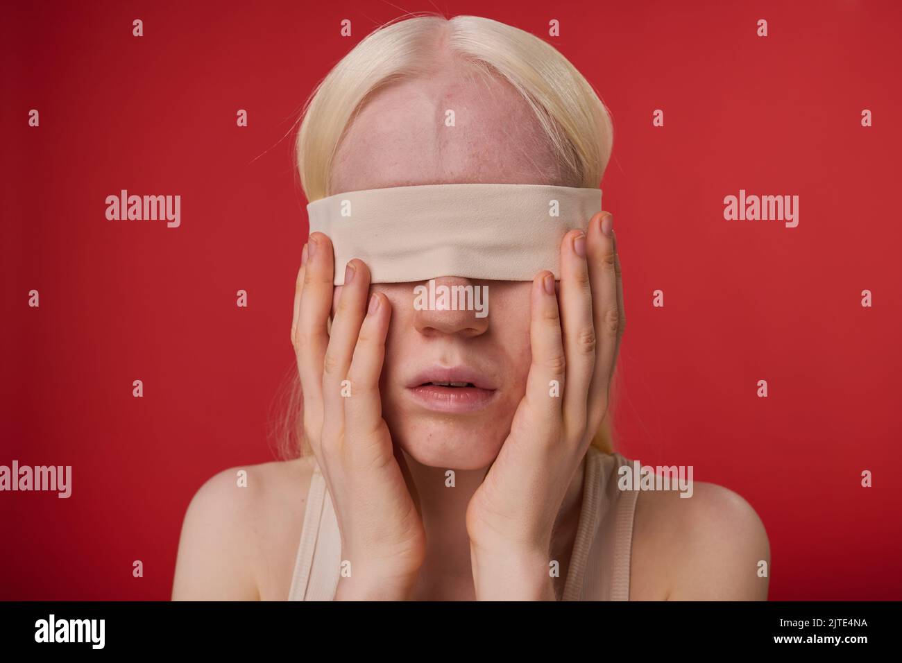 Bandage blind blond caucasian hi-res stock photography and images - Alamy