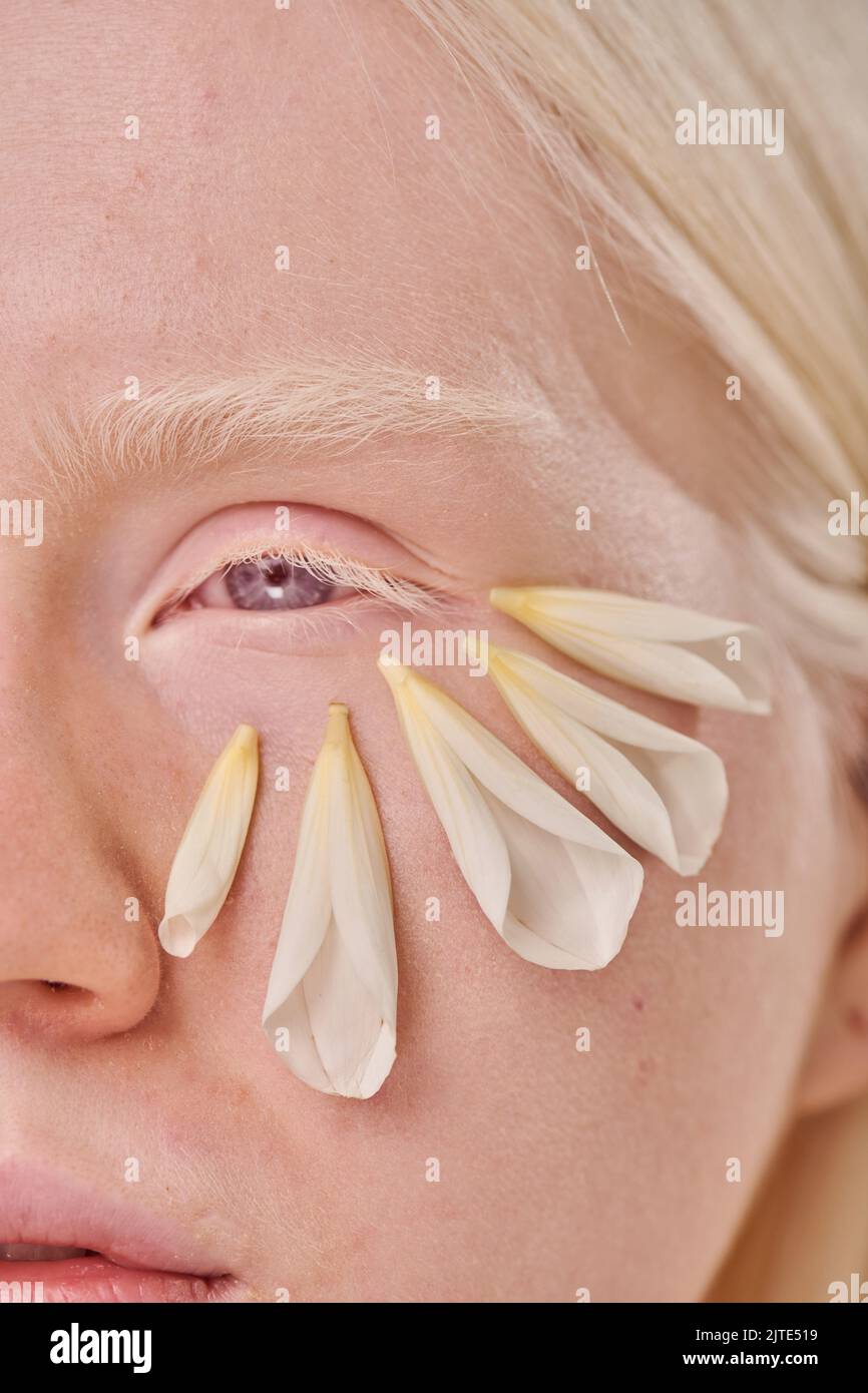 Albino face close up hi-res stock photography and images - Alamy