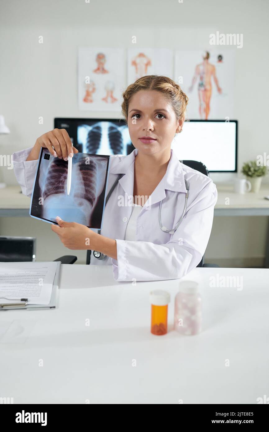 Portrait of young female general practitioner showing lungs x-ray of ...