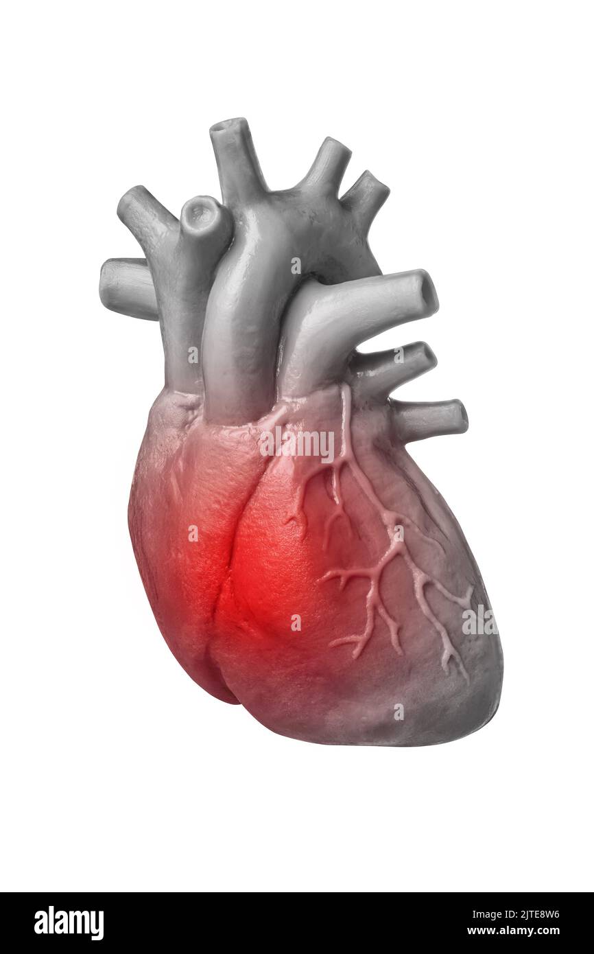 The concept of heartache or heart attack, human heart isolated on white ...