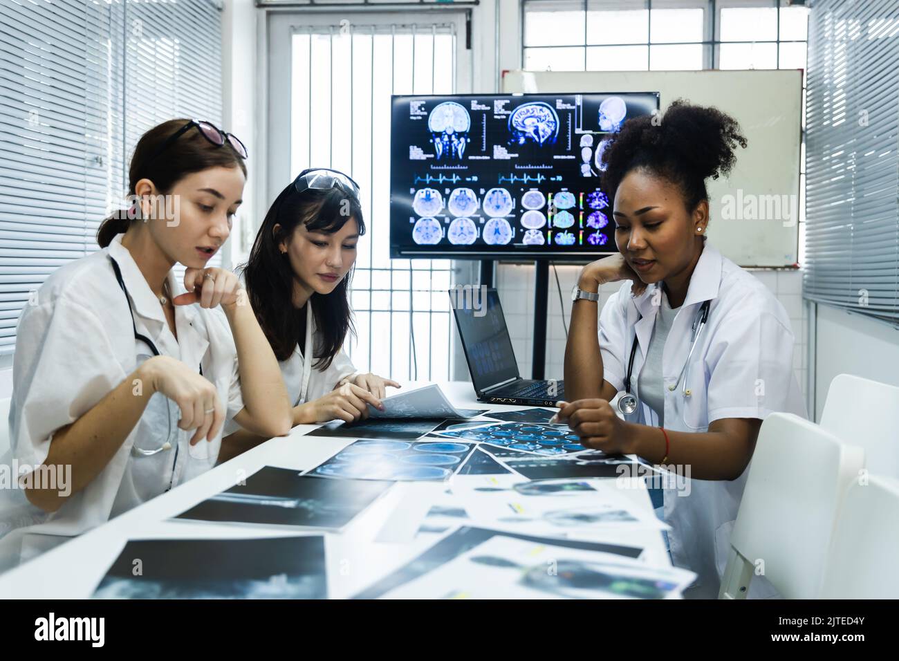 Team of female doctor check on scan results paper and looking at ...