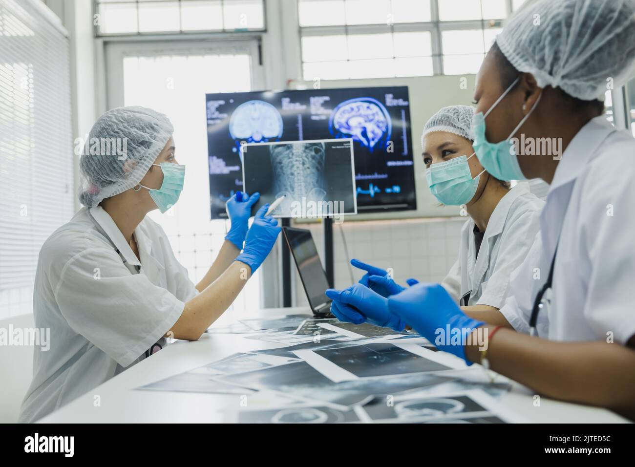 Team of female doctor check on scan results paper and looking at ...