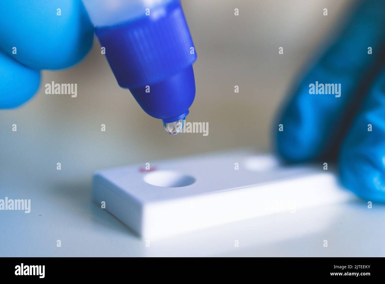Process of express fast coronavirus covid Antigen AG PCR testing ...