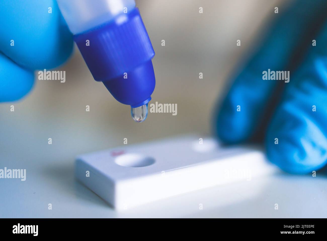 Process of express fast coronavirus covid Antigen AG PCR testing ...