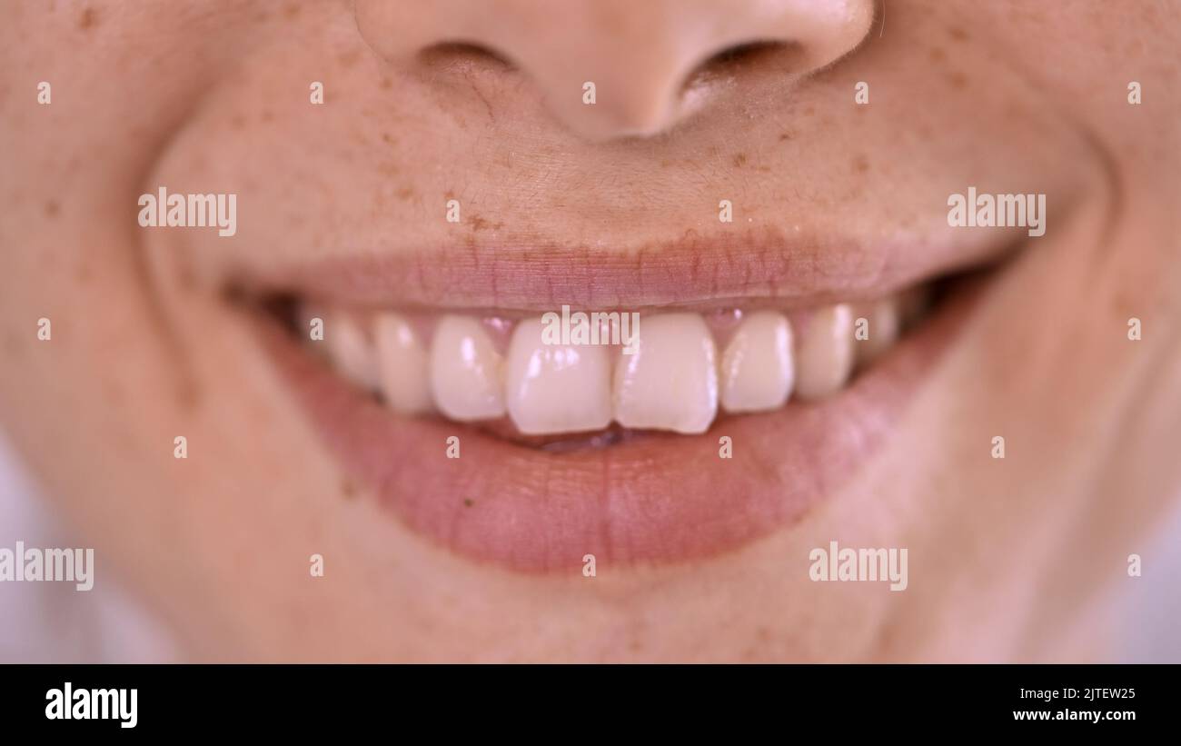 A closeup of the freckled girl's smiling lips showing teeth Stock Photo ...