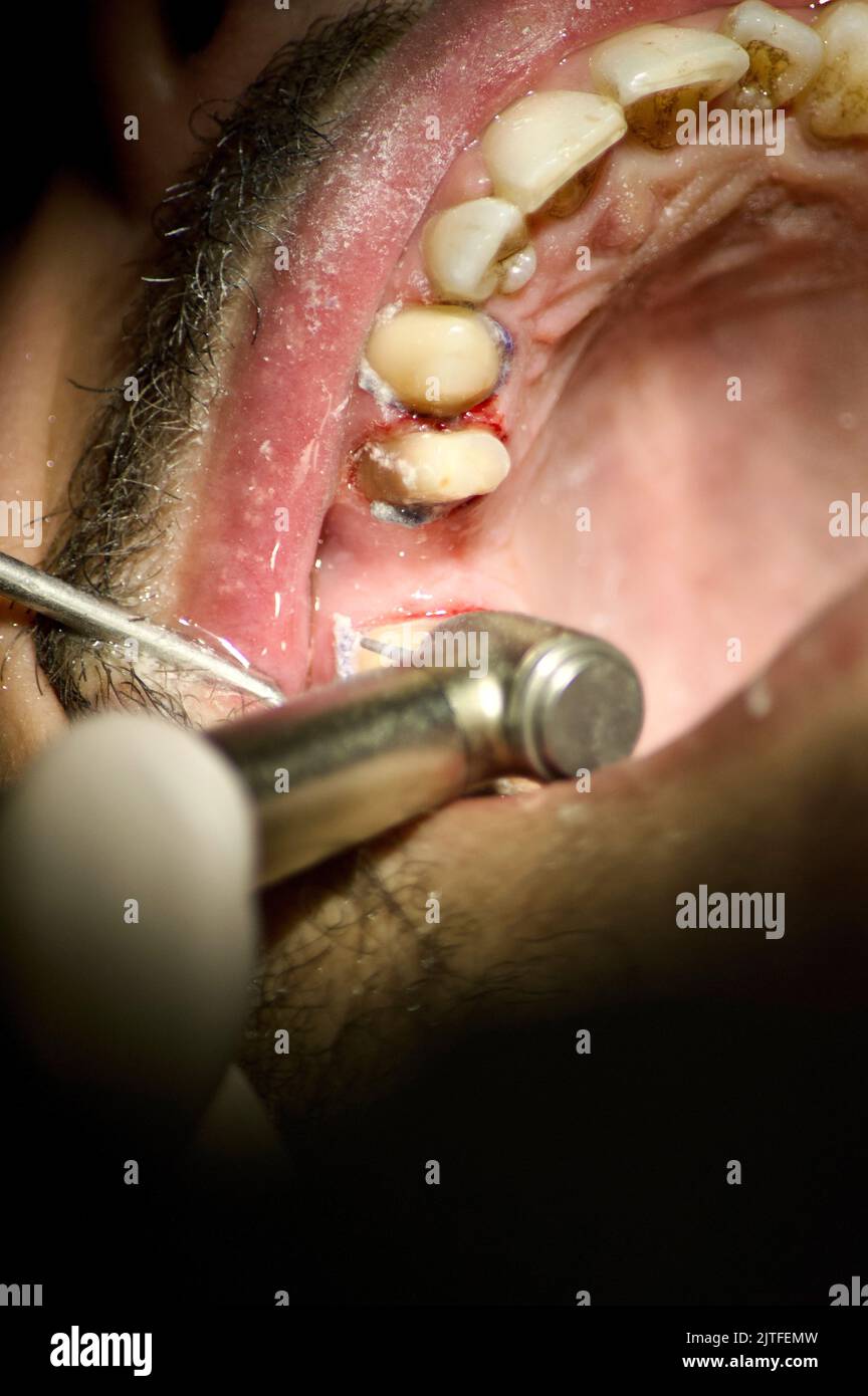 Retraction cord hi-res stock photography and images - Alamy