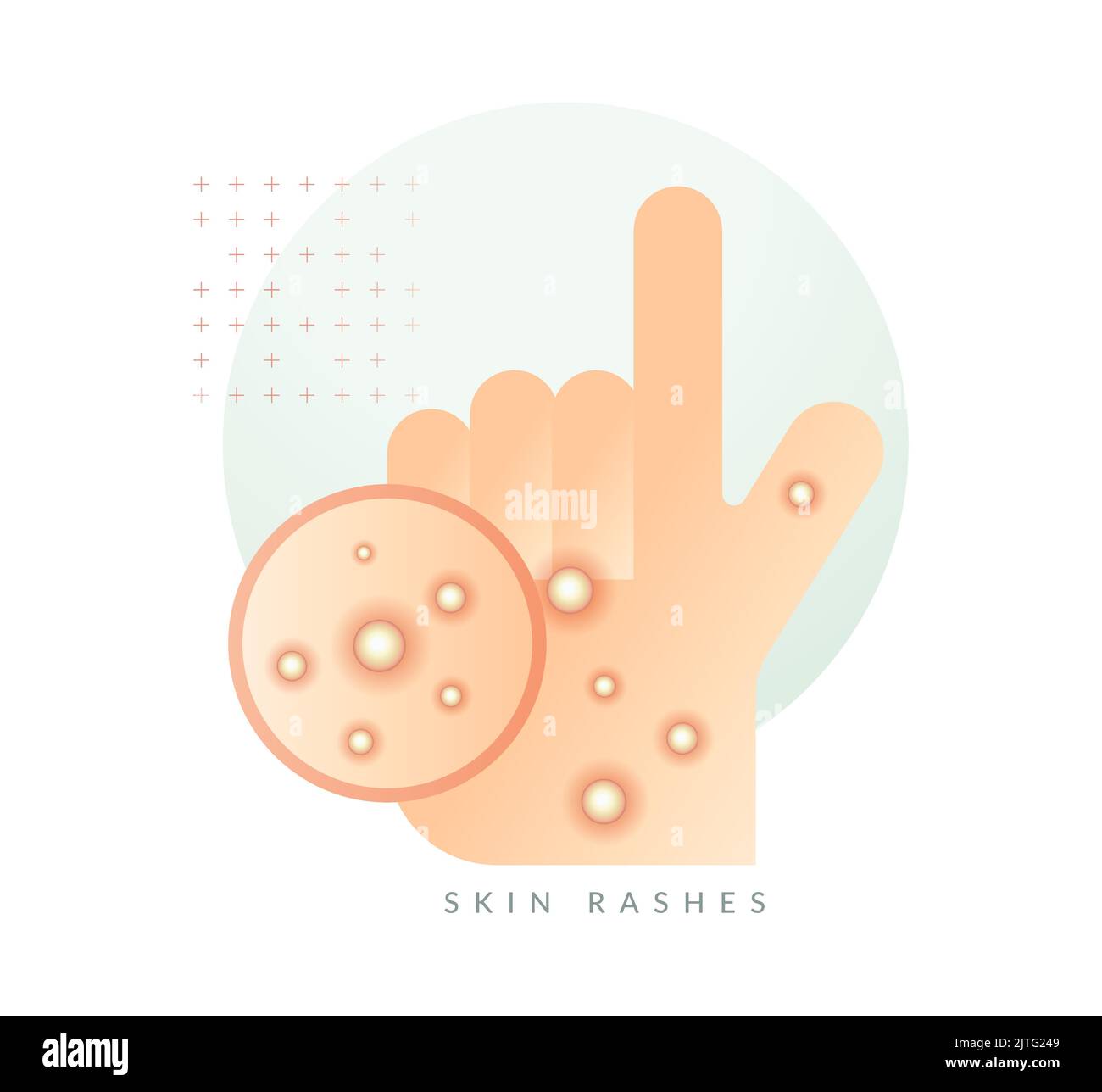 Monkeypox - Skin Rashes and Spots as Symptoms - Icon as EPS 10 File ...